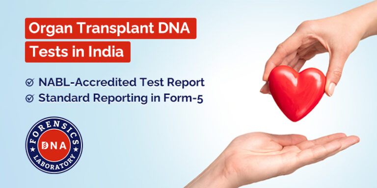 DNA Test for Kidney Transplant | DNA Forensics Laboratory